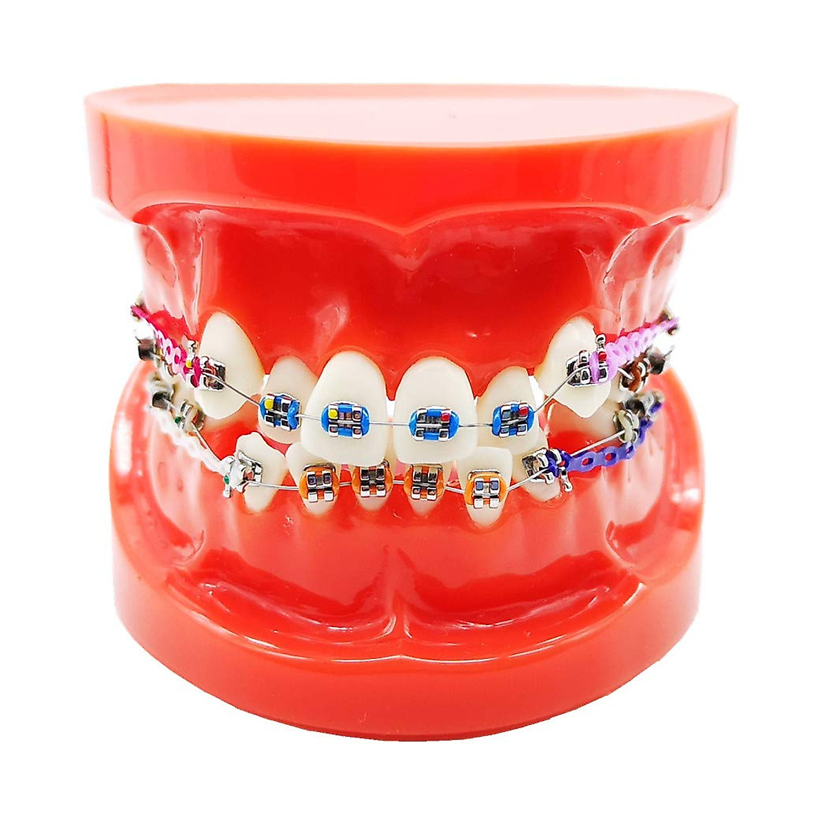 Dental Typodont With Metal Brackets Orthodontic Teeth Model With Ligature Ties Red