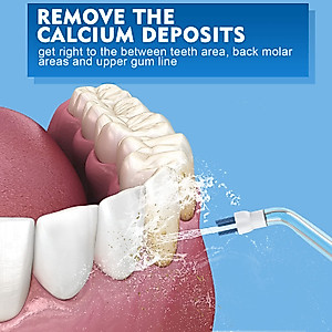 Plaque Seeker Replacement Tips for Waterpik Water Flosser and Other Brand Oral Irrigator 4 Packs