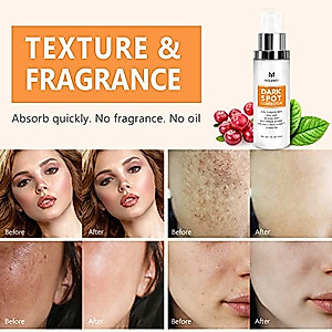 MESANDY Dark Spot Corrector, Dark Spot Remover For Face and Body Serum Formulated with Advanced Ingredient 4-Butylresorcinol, Kojic Acid, Lactic Acid, Salicylic Acid and Licorice Root Extract | Improves Hyperpigmentation, Facial Freckles, Melasma, Brown S