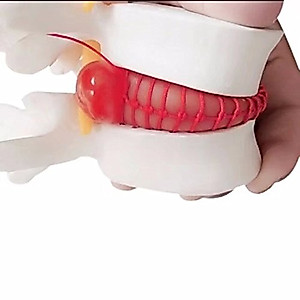 BoNew-Oral 1:1.5 Anatomical Human Lumbar Vertebrae Degenerative Lumbar Human Spine Model White Color