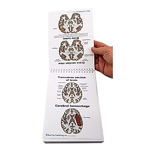 Brain Flip Charts