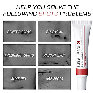 2 Pcs Whitening Freckle Cream, Acne Scar Removal Treatment Cream, Pigmentation Removal Cream for Face, Moisturizing Removes Facial Melasma Dark Spots Wrinkles Blemishes (whitening freckle cream)