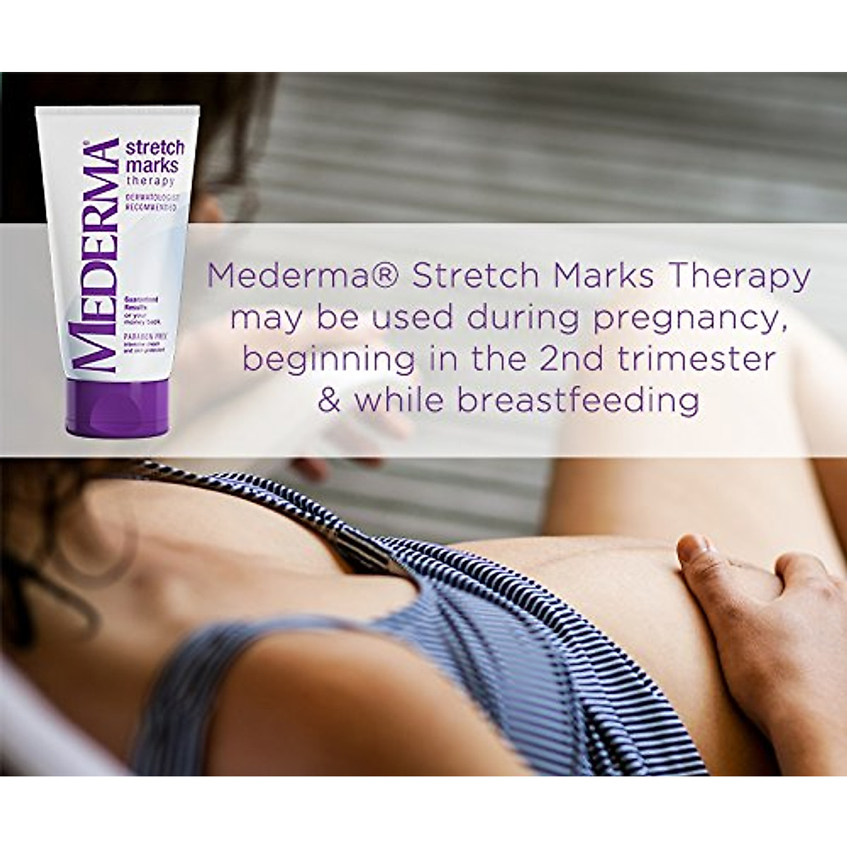 Mederma Stretch Marks Therapy, Hydrates to Help Prevent Stretch Marks, Clinically Shown to Produce Noticable Improvement in 4 Weeks, Dermatologist Recommended, Ivory, 5.29 Ounce
