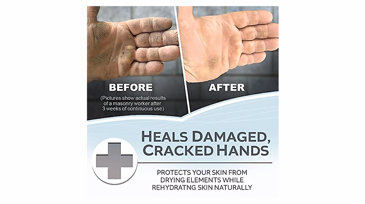 WORKMAN'S FRIEND Barrier Cream | Heal & Protect Dry Skin