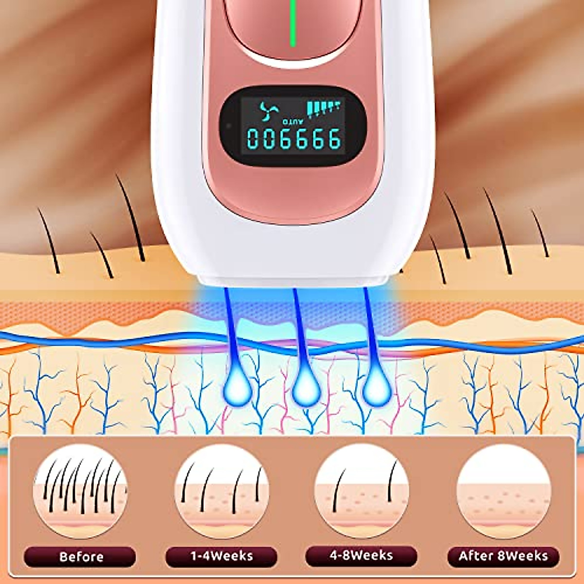 IPL Hair Removal for Women and Men, New Upgraded 999,900 Flashes Permanent Laser Hair Removal Device on Facial Legs Arms Armpits Body, At-Home Use