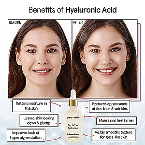 grace & stella Award Winning Hyaluronic Acid Serum (50ml/1.7 fl oz) Hyaluronic Acid Serum for Face - Acido Hialuronico Face Serum for Women - Hydrating Serum Remove Fine Lines, Wrinkles - Anti Aging