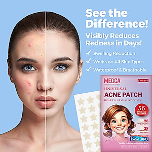 MEDca Acne Patches for Face - Hydrocolloid Bandages (56 Count) Pimple Patches for Face in Hearts & Stars, Acne Spot Treatment Care for Face & Skin Spot Patch Conceals Zits, Acne and Blackheads
