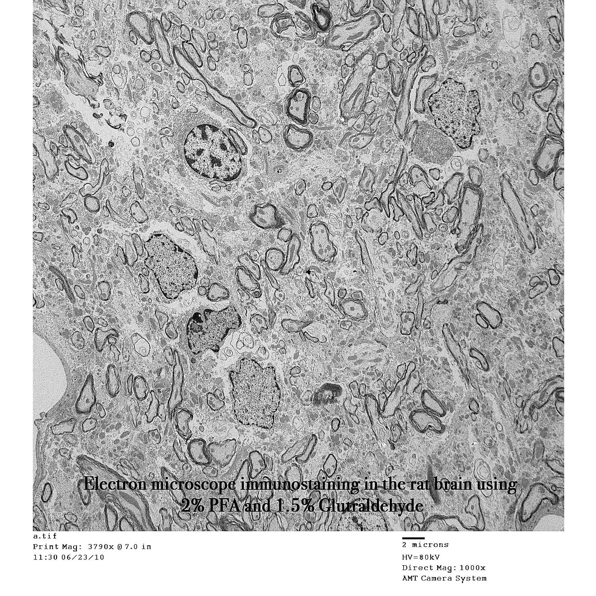 Paraformaldehyde, 4% in PBS - 500 mL - PFA04-500R