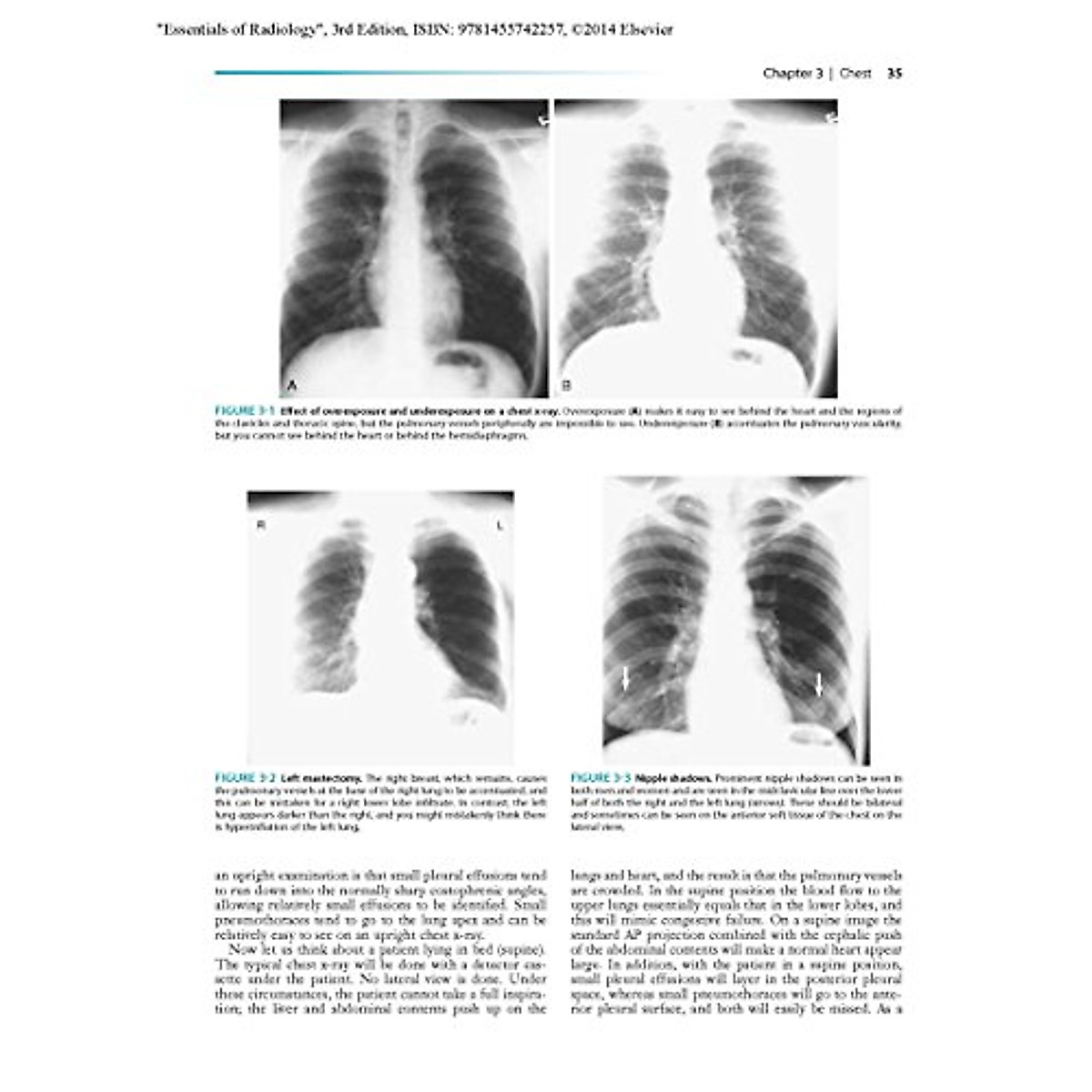 Essentials of Radiology: Common Indications and Interpretation (Mettler, Essentials of Radiology)