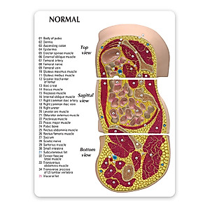 Obesity Model | Human Body Anatomy Replica of Overweight Body Types for Doctors Office Educational Tool | GPI Anatomicals