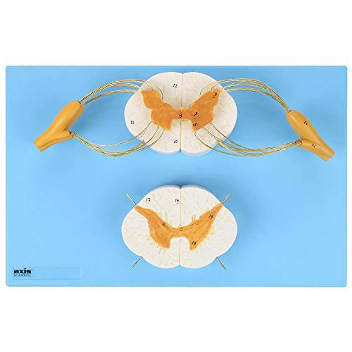 Axis Scientific Enlarged Spinal Cord Model, 8X Life Size Nerves Plus Anterior and Posterior Nerve Roots and Spinal Ganglion - Includes Product Manual, and Base for Display