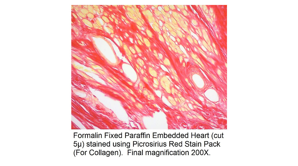 Picrosirius Red Stain Pack for Effective Collagen Staining