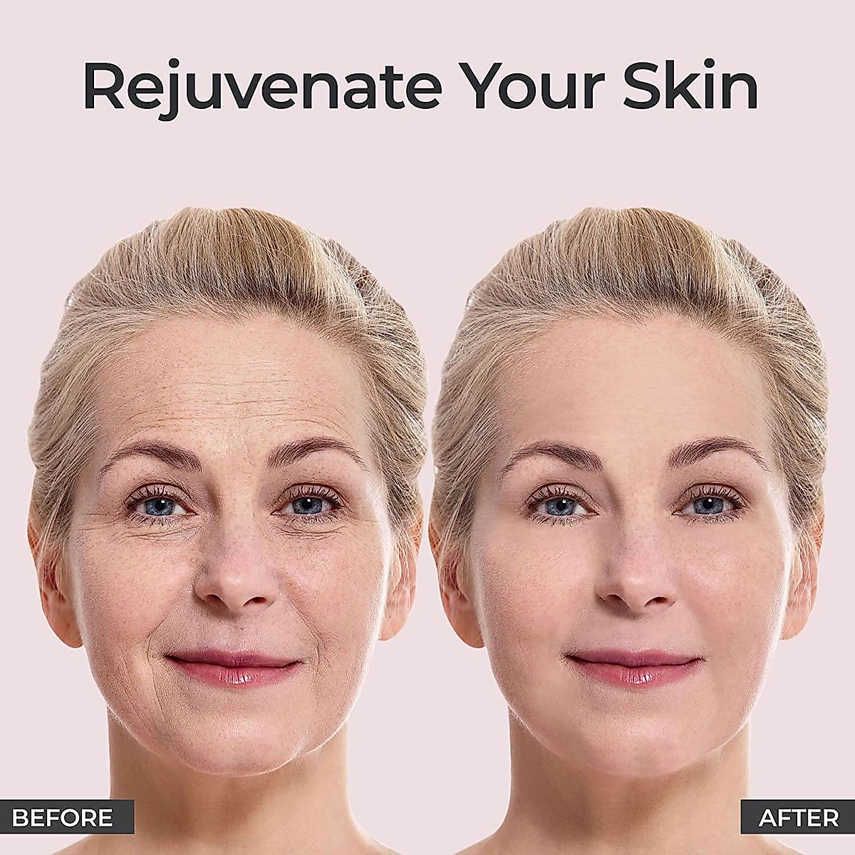 Pespire Silicone Face Patches - Reusable Facial Wrinkle Remover Pads: Deep Wrinkle Plumping Patch Masks for Face, Eyes & Mouth Skincare - Overnight Sleeping Mask for Eye Lines & Smile Wrinkles