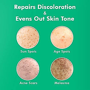 Ebanel Dark Spot Remover for Face Peel Skin Brightening Cream Melasma Hyperpigmentation Treatment Sun Spot Age Spot Freckle Remover Fade Cream, Synovea, 4-Butylresorcinol, Niacinamide, Glutathione