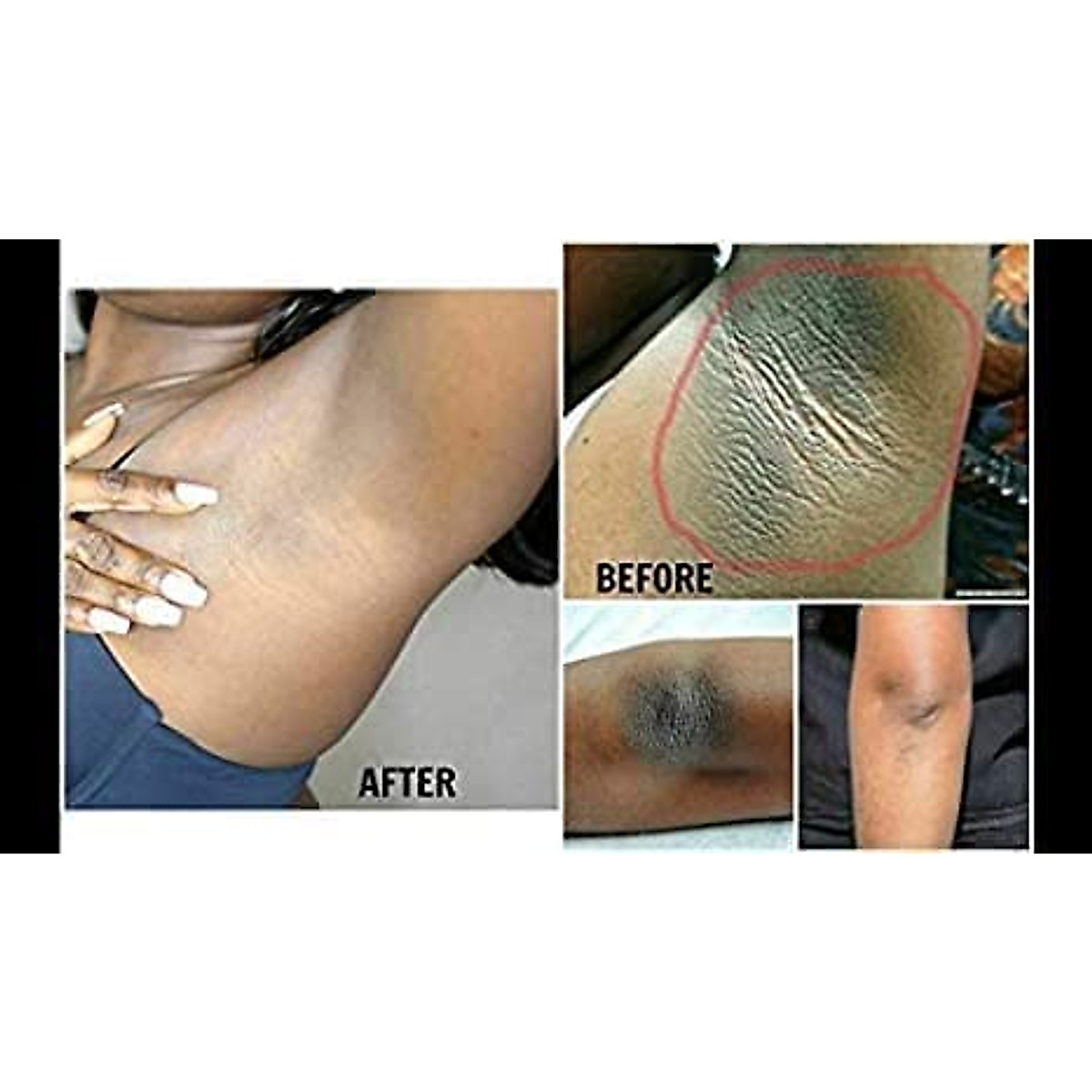 ZWSP Armpit Whitening Cream Skin Lightening Bleaching Cream For Underarm Dark Skin Legs Knees Whitening Intimate Body Lotion