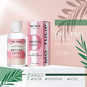 MO TULIP Acne Drying Lotion, Overnight Acne Acid and Acne Spot Treatment for Face and Body, Pimple Lotion Spot Treatment, Dry Out Pimples, Blemishes, and Clean pores (1OZ)