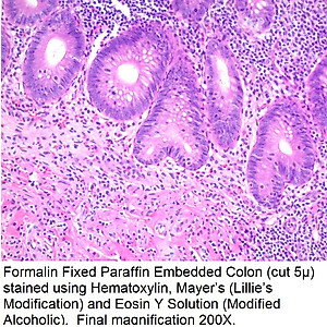 Hematoxylin, Mayer's (Lillie's Modification), 1000ml