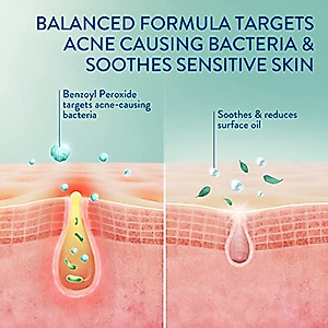 Cetaphil Gentle Clear Complexion-Clearing BPO Acne Cleanser with 2.6% Benzoyl Peroxide, Creamy and Soothing for Sensitive Skin, Suitable for All Skin Types, 4.2oz