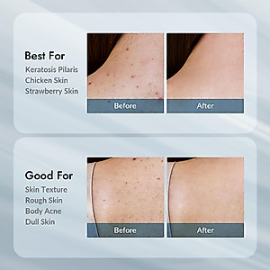 VILLAGE11FACTORY AHA 12% Body Lotion Korean Body Cream Exfoliating & Rejuvenating Formula with Glycolic Acid and Hyaluronic Acid Unscented (10.6 Oz)