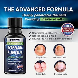 Tobcharm Toenail Fungus Treatment Extra Strength, Nail Fungus Treatment for Toenail, Fungus Nail Treatment, Nail Fungus Treatment for Fingernails (1oz)