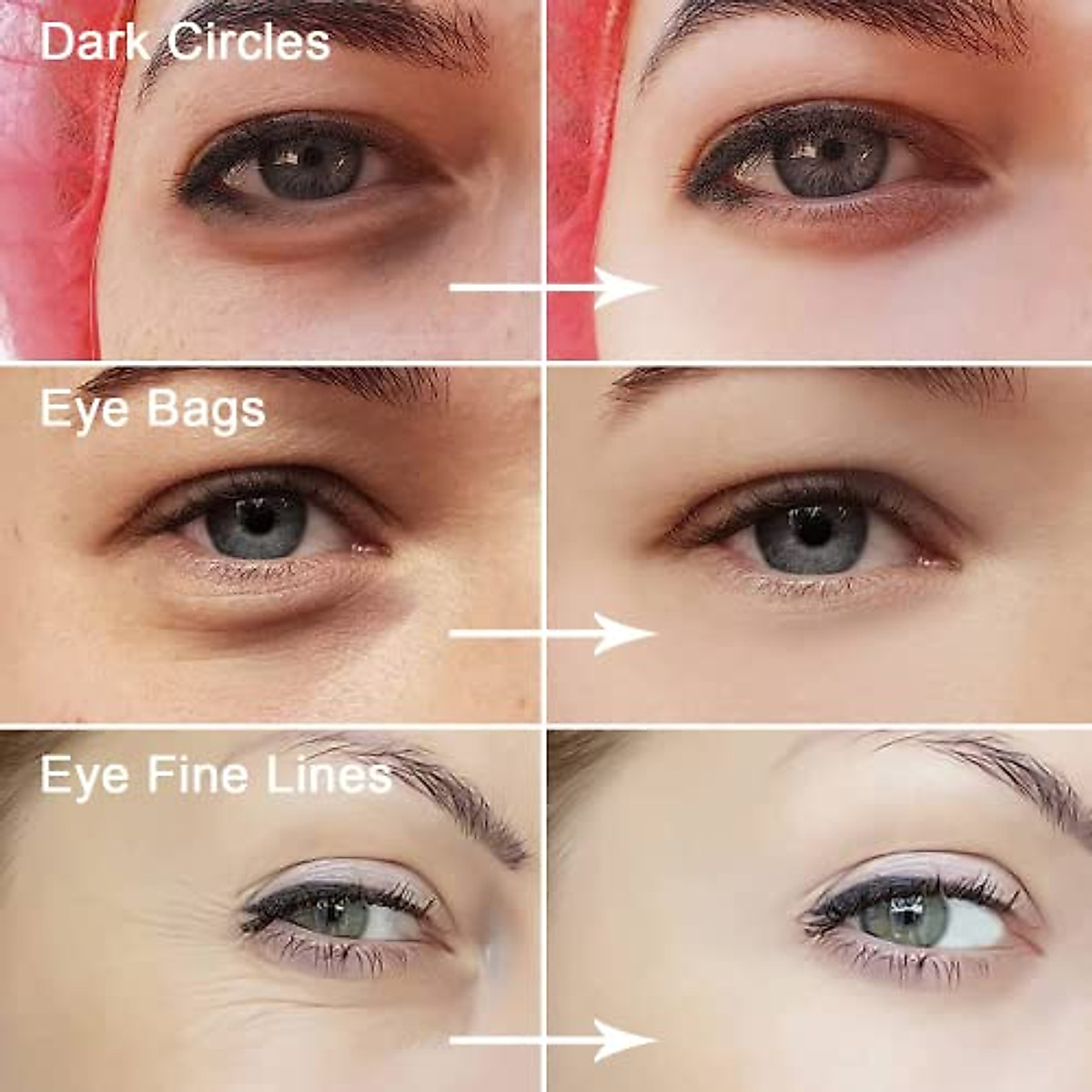 cgify 25 Pairs Under Eye Patches, 24K Gold Eye Mask, Under Eye Pads for Puffy Eyes, Dark Circles, Eye Bags and Wrinkles, Collagen Under Eye Masks for Women Men