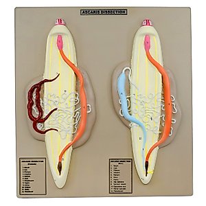 EISCO Ascaris Model, Male & Female - Enlarged, Dissection with Hand Painted Details - Mounted on Base, 14" x 13"