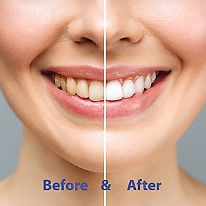 Chomp Super Whitening Cinnamon Toothpaste Tablets with Nano Hydroxyapatite Refill