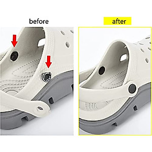 LUAATT Universal Beach Shoes Replacement Rivets,10 Set Repair Plastic Button for Men and Women Summer Shoes Strap (Black)