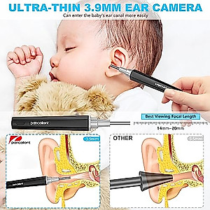 Pancellent Digital Otoscope Camera with Light, Ear Camera, Video Ear Scope with Ear Wax Removal Tools, Ear Endoscope Cleaner, Compatible with iPhone, iPad, Android Smart Phone (Basic Edition Black)