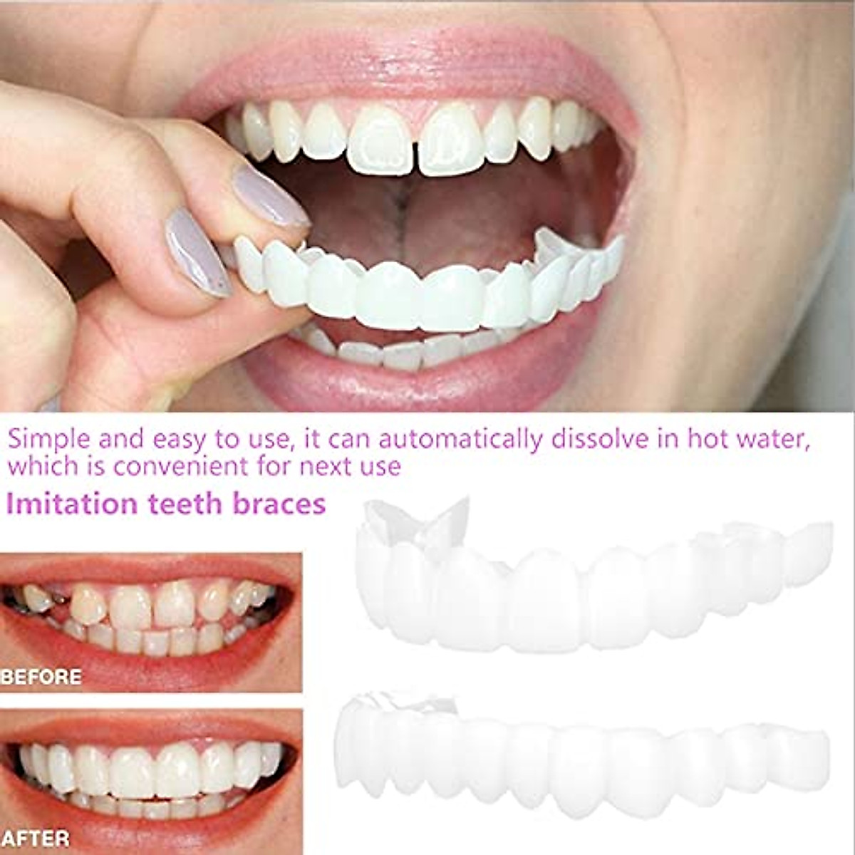 icehao Upper & Lower Teeth Veneers - Simulation Braces Snap On Smile Tooth Cover Perfect Whitening One Size Fits Most Comfortable Denture to Make White Beautiful Neatr (2pcs) 2 Count (Pack of 1)