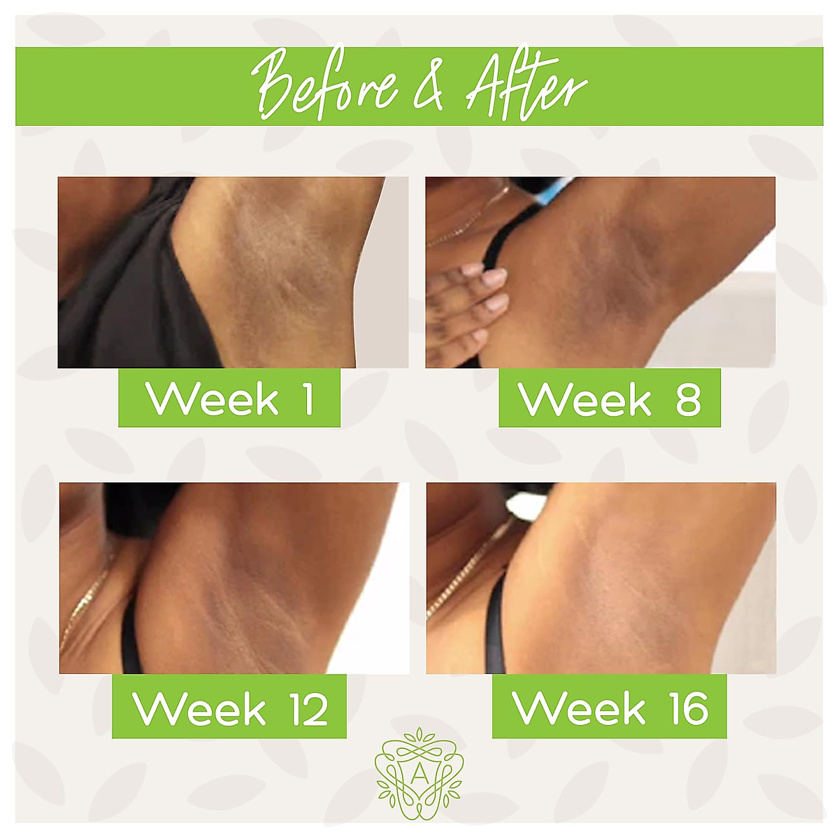 Amaira Skincare Intimate Natural Brightening Serum - Kojic Acid Dark Spot Corrector - Formulated for Sensitive Skin and Private Areas - Natural Plant-Based Formula (1.7 fl oz)