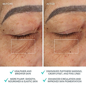 FOREO Bear Microcurrent Facial Device - Face Sculpting Tool - Instant Face Lift - Firm & Contour - Non-Invasive - Increases Absorption of Facial Skin Care Products - Mint