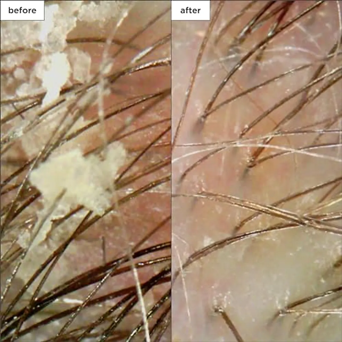 Briogeo Scalp Revival Soothe + Detoxify Minis Kit, Soothe a Dry, Flaky, Itchy Scalp, Clarify Build Up, Scalp Detox, Unclog Hair Follicles,Travel Kit, Vegan, Cruelty-Free, 4-Piece Set