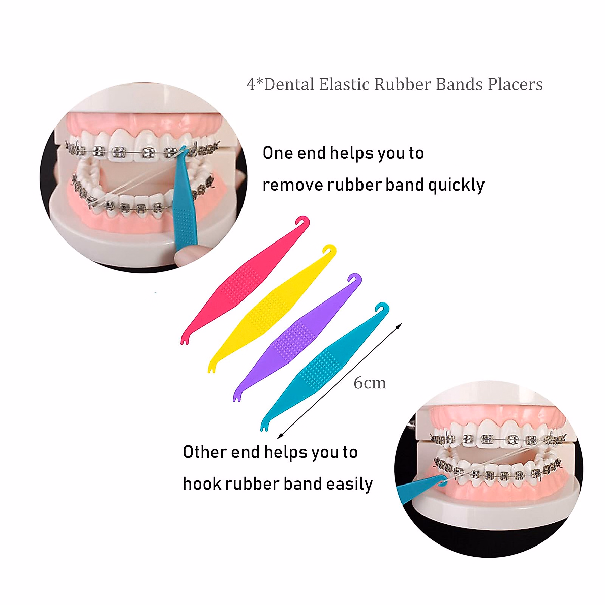 HRASY Oral Care Disassembly Kit/7pcs Including 1 Retainer Case With Mirror and Vent Holes | 1 Aligner Remover Tool | 4 Elastic Rubber Bands Placers | 1 Cleaning Brush (Blue)