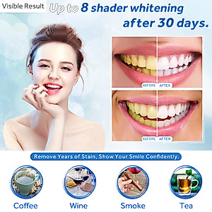 EZGO Dental Mobile Teeth Whitening Lamp Cold Bleaching Teeth Whitening Blue Light Machine LED Teeth Whitener Accelerator Light,Teeth Whitening Gel Refill Pack, 20 Pieces C-Shape Cheek Retractor
