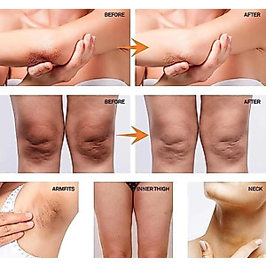 Snow Bleach Cream, Snow Bleaching, Snow Bleach Cream For Private Part Underarm Whiten (1 PCS)