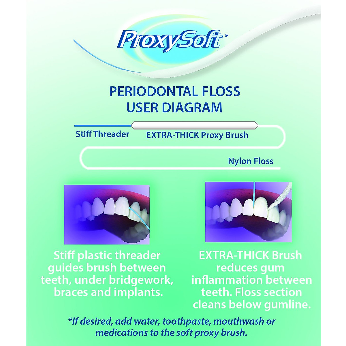 ProxySoft Periodontal Floss, 1 Pack - Dental Floss Threader, Braces Floss and Thick ProxyBrush for Daily Care of Periodontal Disease and Gum Health - Orthodontic Flossers for Braces and Teeth