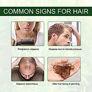 Rosemary Oil for Hair Growth,Rosemary Essential Oil for Hair Loss Regrowth Treatment,Strengthens Hair,Nourishes Scalp,Light Weight,Non Greasy,Improves Scalp Circulation For Men And Women 2.02 Oz