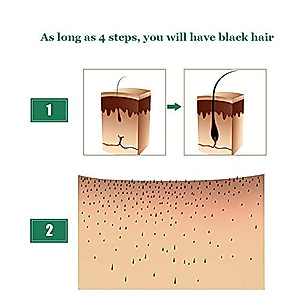 5 PACK Hair Growth Serum Liquid Hair Loss Treatment for Women & Men Dense Thicken Hair