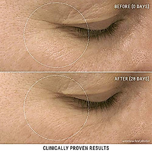 BIOSSANCE Squalane + Vitamin C Rose Oil. Facial Oil to Visibly Brighten, Hydrate, Firm and Reveal Radiant Skin. Travel Size (0.4 ounces)