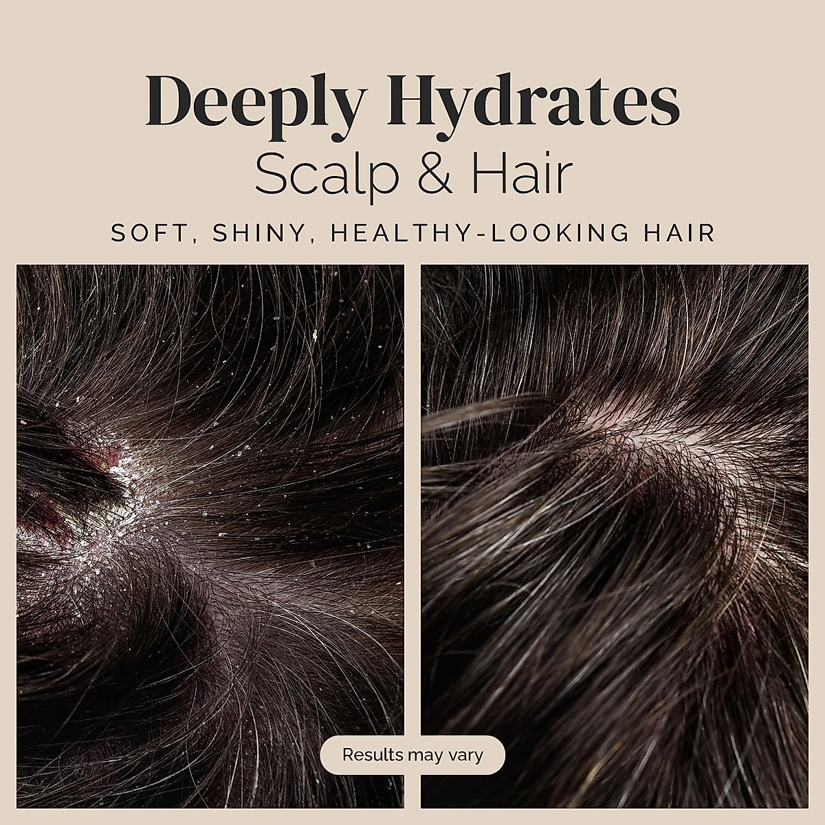 Puriya Tea Tree Clarifying Shampoo. Plant Rich Dry Itchy Scalp Relief, for Kids, Adults, Sulfate Free, No Harsh Chemicals Seen in Dandruff Treatment, Seborrheic Dermatitis, Psoriasis Shampoo, 16 oz