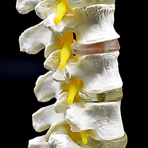 Medical Human Lumbar Spine Demonstration Model Anatomical Model Lumbar Vertebrae Sacrum & Coccyx, with Herniation Disc,for Science Classroom Study Display Teaching Medical Model 15 Inch Hight