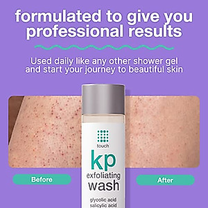 Touch Keratosis Pilaris Exfoliating Body Wash Cleanser - KP Treatment with 15% Glycolic Acid, Aloe Vera, & Hyaluronic Acid - Smooths Rough & Bumpy Skin - Gets Rid Of Redness, 8 Ounce