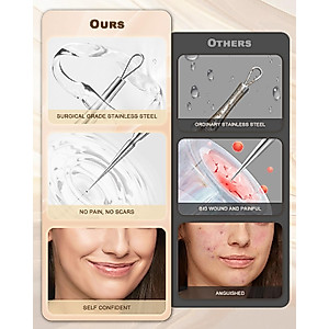 SGNEKOO Professional Facial Milia Removal Tool and Whitehead Extractor,Titanium Alloy Double Ended Needle and Steel Tweezers Kit,Blackhead,Blemish,Zit and Pimple Acne Remover Popper (Titanium Gold)