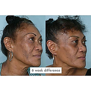 dEpPatch DARK SPOT Correcting Cream with ANTI AGING Peptides for Face and Body | Tighten, Maintain Even Radiant Skin Tone| All Natural Active Ingredients, Made in the USA (1 fl oz)