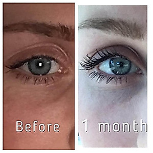 Hairgenics Pronexa FantastiLash – Eyelash Conditioner & Brow Conditioning Serum with Castor Oil Strengthens, Nourishes and Protects for Perfect Eyelashes and Brows.