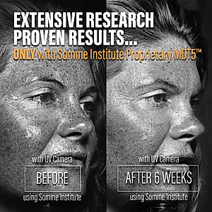 Exfoliating Glycolic Acid Pads | Anti-Aging, Smoothing, Resurfacing Pads | Somme Institute Transport Alcohol-Free Brightening Pads for Gentle Dirt Removal and Pore Cleansing | 50 Ct.