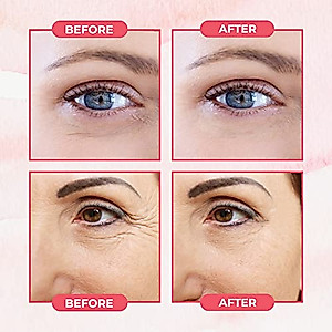 Retinol Eye Stick, Retinol Eye Cream for Dark Circles and Puffiness, Visible Results in 3-4 Weeks, Under Eye Cream Anti Aging, Eye Brightener Stick, Eye Cream for Wrinkles, Brightening Eye Cream for Puffiness and Bags under Eyes, Brightening Eye Balm Redu