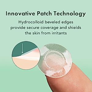 Rael Pimple Patches, Miracle Microcrystal Spot Cover - Hydrocolloid Acne Patch with Tea Tree Oil, Early Stage Zits and Blemish, Korean Skin Care, Vegan, Cruelty Free (36 Count)