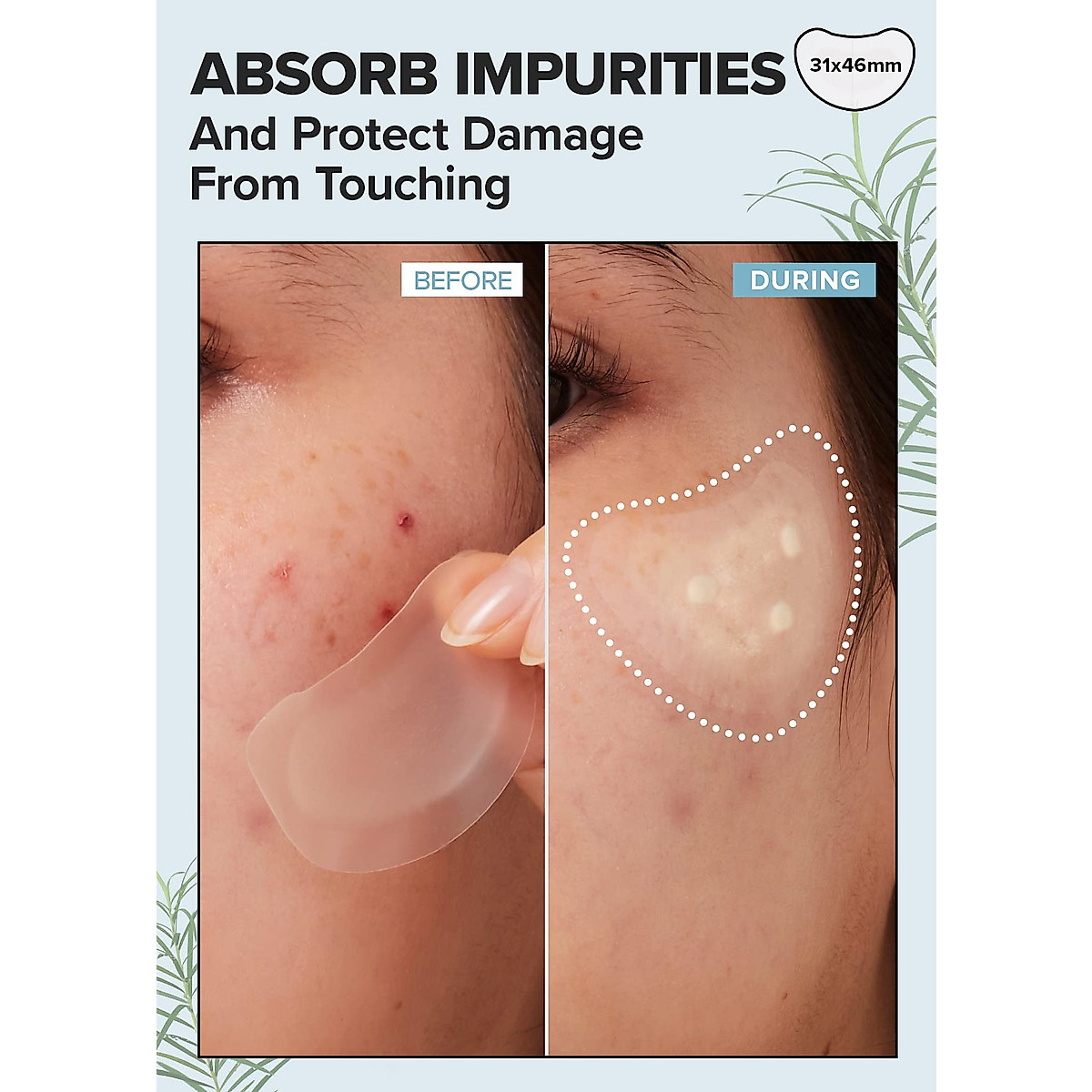 I DEW CARE Hydrocolloid Acne Pimple Patch - Timeout Blemish Chin & Chicks + Timeout Blemish Happy Paws Bundle